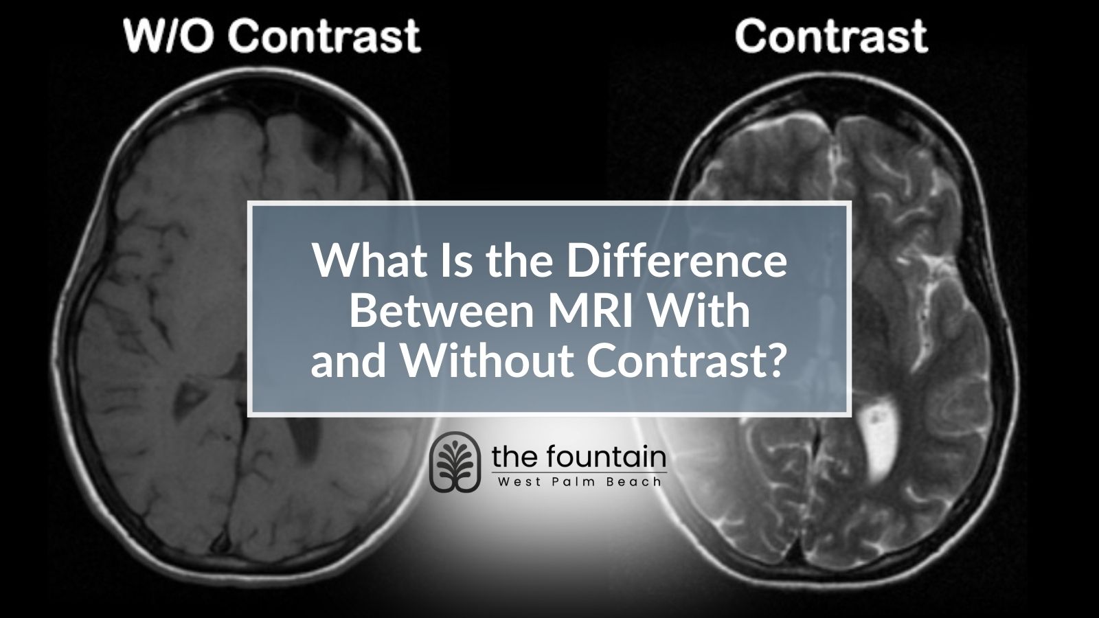 What Is the Difference Between MRI With and Without Contrast? - The ...